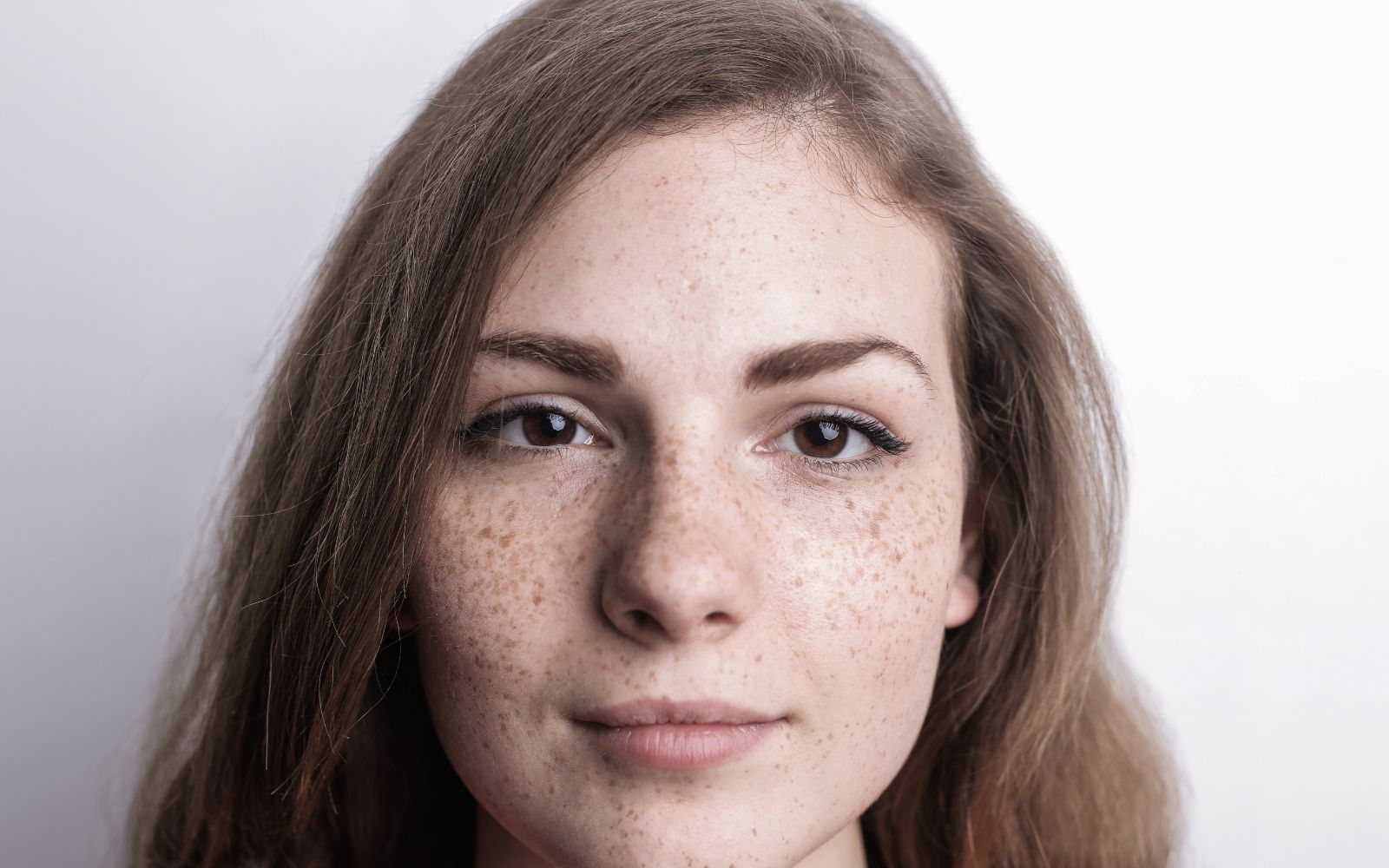 BROCCOLI FRECKLES ARE TRENDING ON TIKTOK - Z93